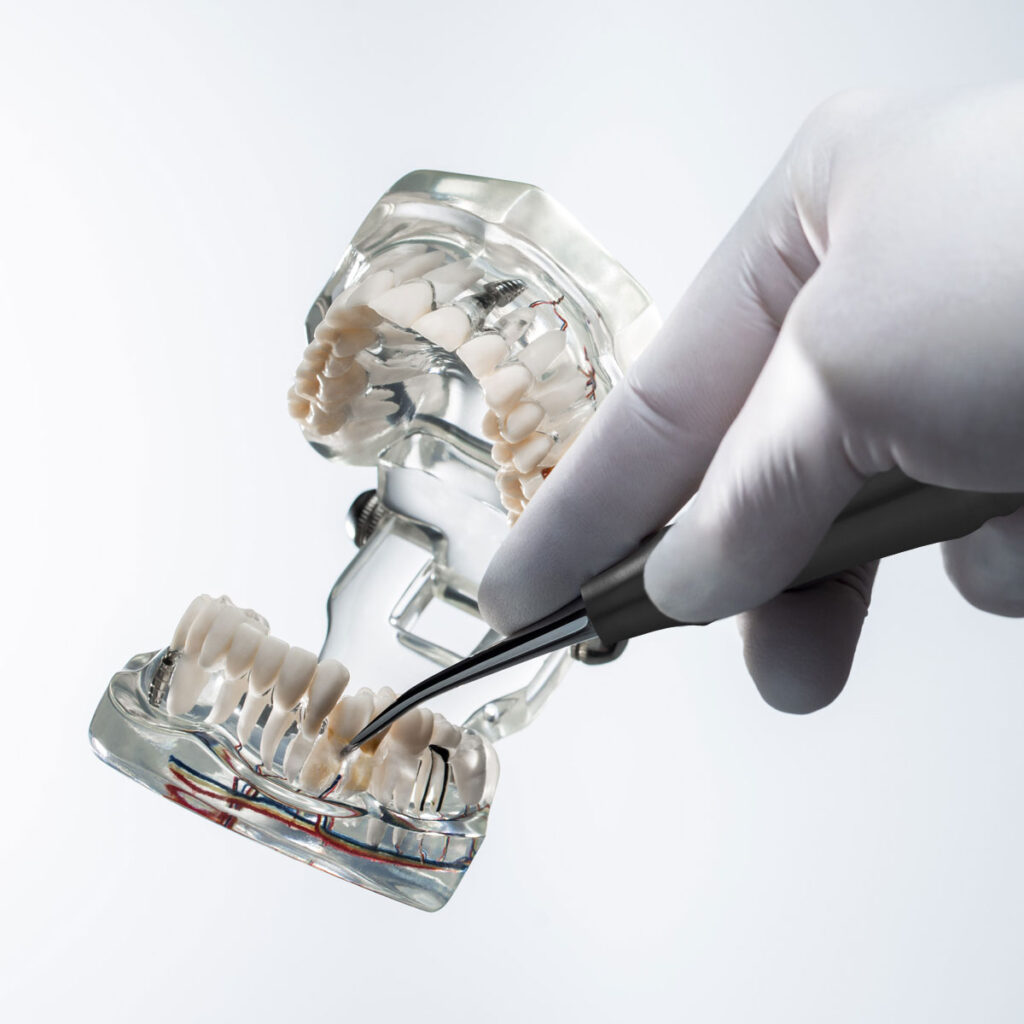 Extraktion Instruments - American Eagle Instruments