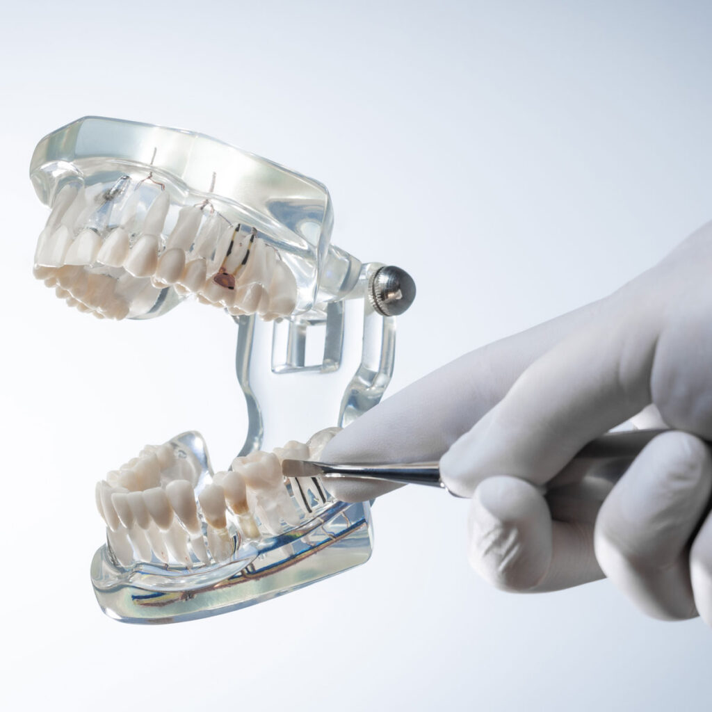 Extraktion Instruments - American Eagle Instruments