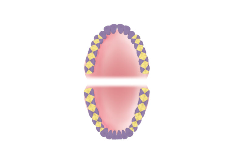 XP Double Gracey™ - American Eagle Instruments