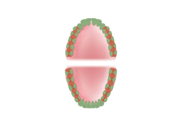 XP Double Gracey™ - American Eagle Instruments