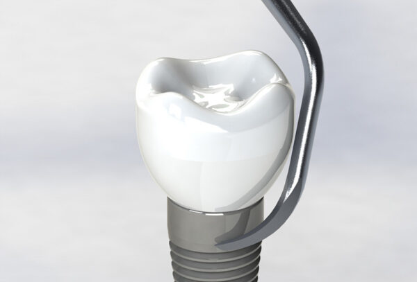 Titanium Implant Instruments | American Eagle Instruments